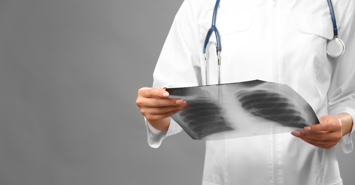 Karriereguide: Sådan bliver du radiograf | Se dine muligheder lige her